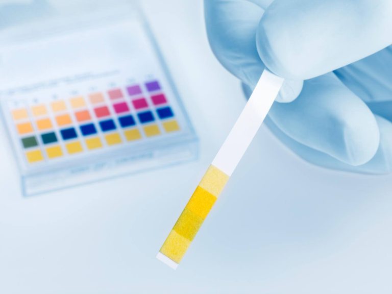 O espectro de cores da urina: o que é normal e o que não é - Rede de ...