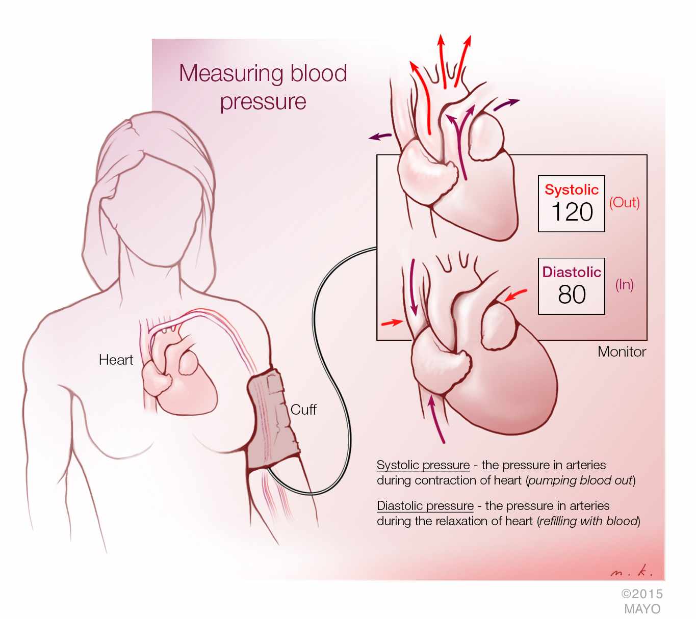 Prolonged Shortened Sleep Increases Blood Pressure At Night Mayo