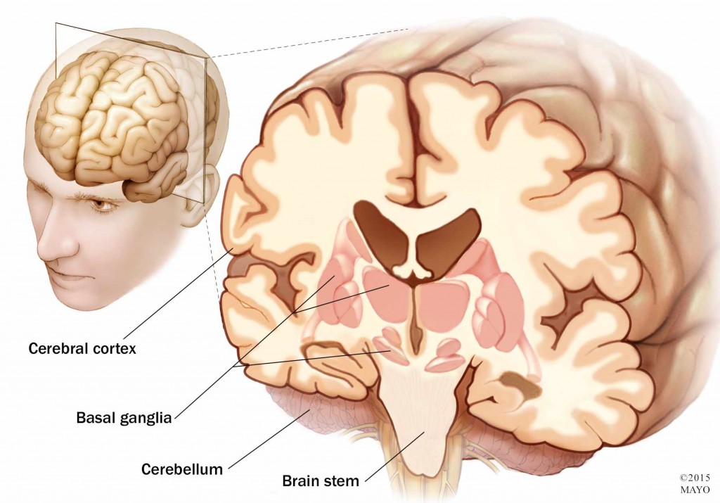 Focusing on the Biology of the Brain - Mayo Clinic News Network