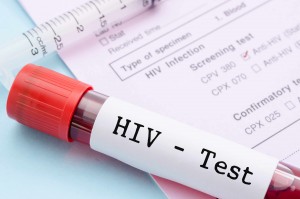 HIV: The Human Immunodeficiency Virus Explained - Mayo Clinic News Network
