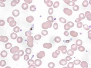 Parasite Wonders: The souvenir from South America - Mayo Clinic News ...