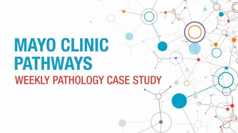 Mayo Clinic PathWays: What's the diagnosis? - Mayo Clinic News Network