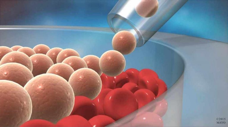 Expert alert: Five key medical advances related to bone marrow ...