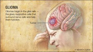 Research provides critical information about the size and growth speed ...