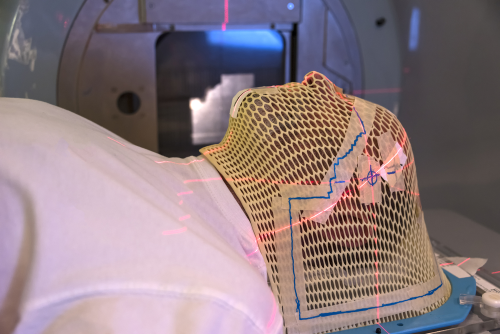 New Radiotherapy Treatment For Brain Cancer Offers Superior New Radiotherapy Treatment For Brain Cancer Offers Superior