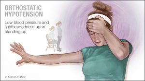Mayo Clinic Q and A: Treating orthostatic hypotension - Mayo Clinic ...