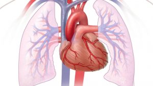 Mayo Clinic Q&A podcast: Why some patients need a second heart surgery ...