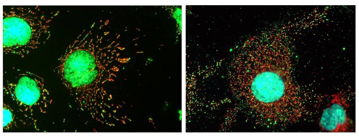 Mayo Clinic researchers clarify how cells defend themselves from ...
