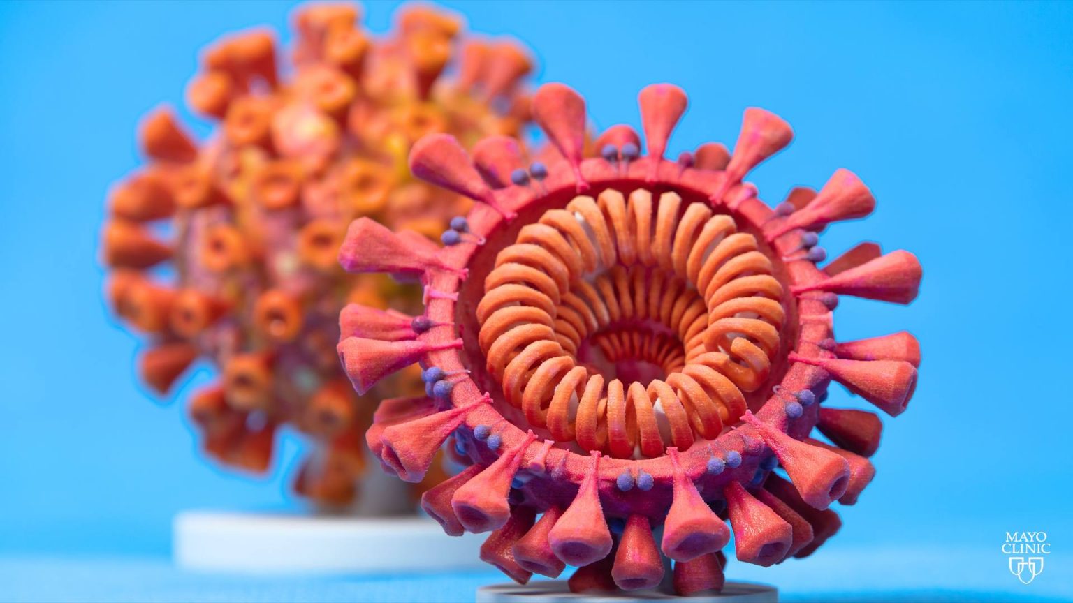 3D Anatomic Modeling Lab prints model of virus that causes COVID-19 ...