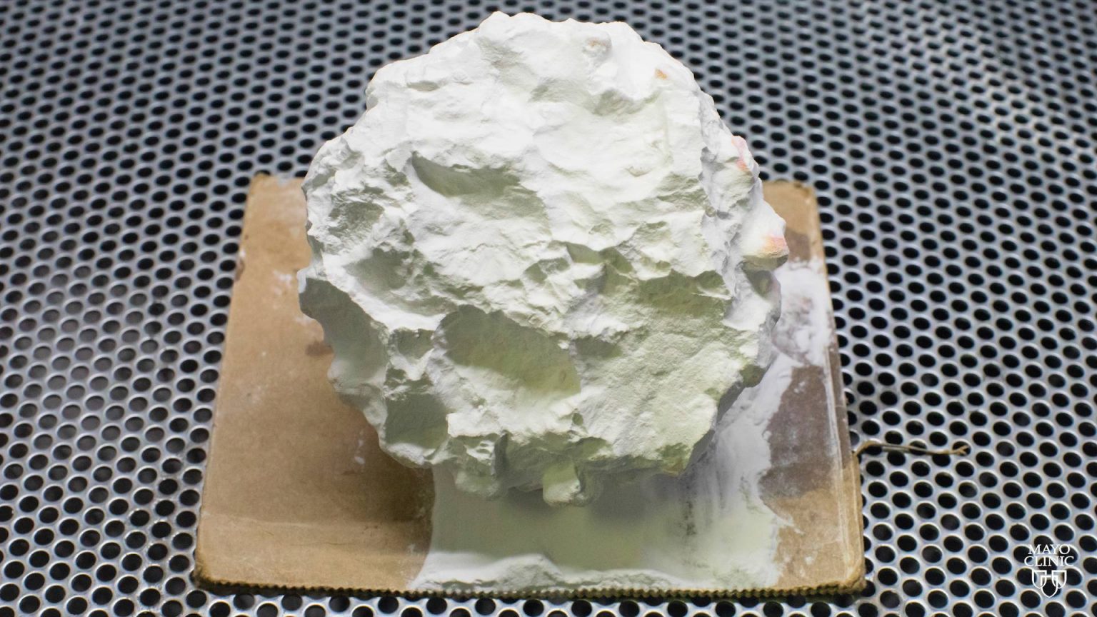 3D Anatomic Modeling Lab prints model of virus that causes COVID-19 ...