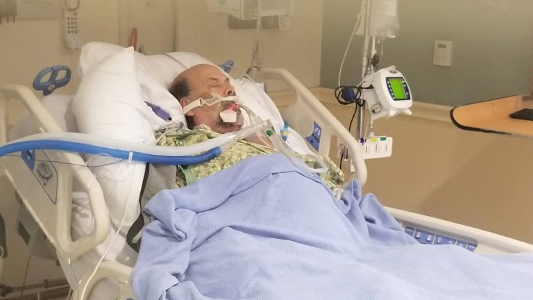 Why some intubated COVID-19 patients may need tracheal reconstruction ...