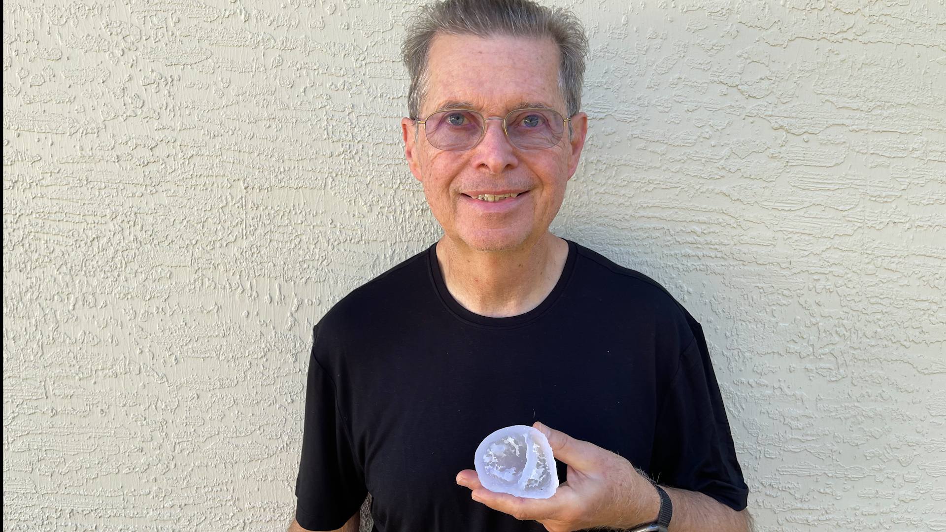How a 3D model, surgery helped a Florida father avoid a heart ...