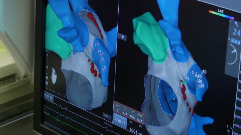Using AI in radiology clinical practice - Mayo Clinic News Network