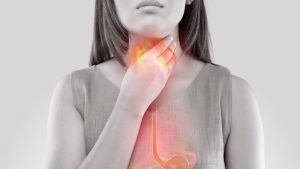 Mayo Clinic Healthcare expert explains why reflux disease isn't `just ...