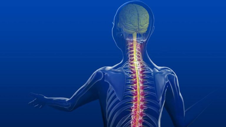 Pain in the back: Preventing and treating spinal arthritis - Mayo ...