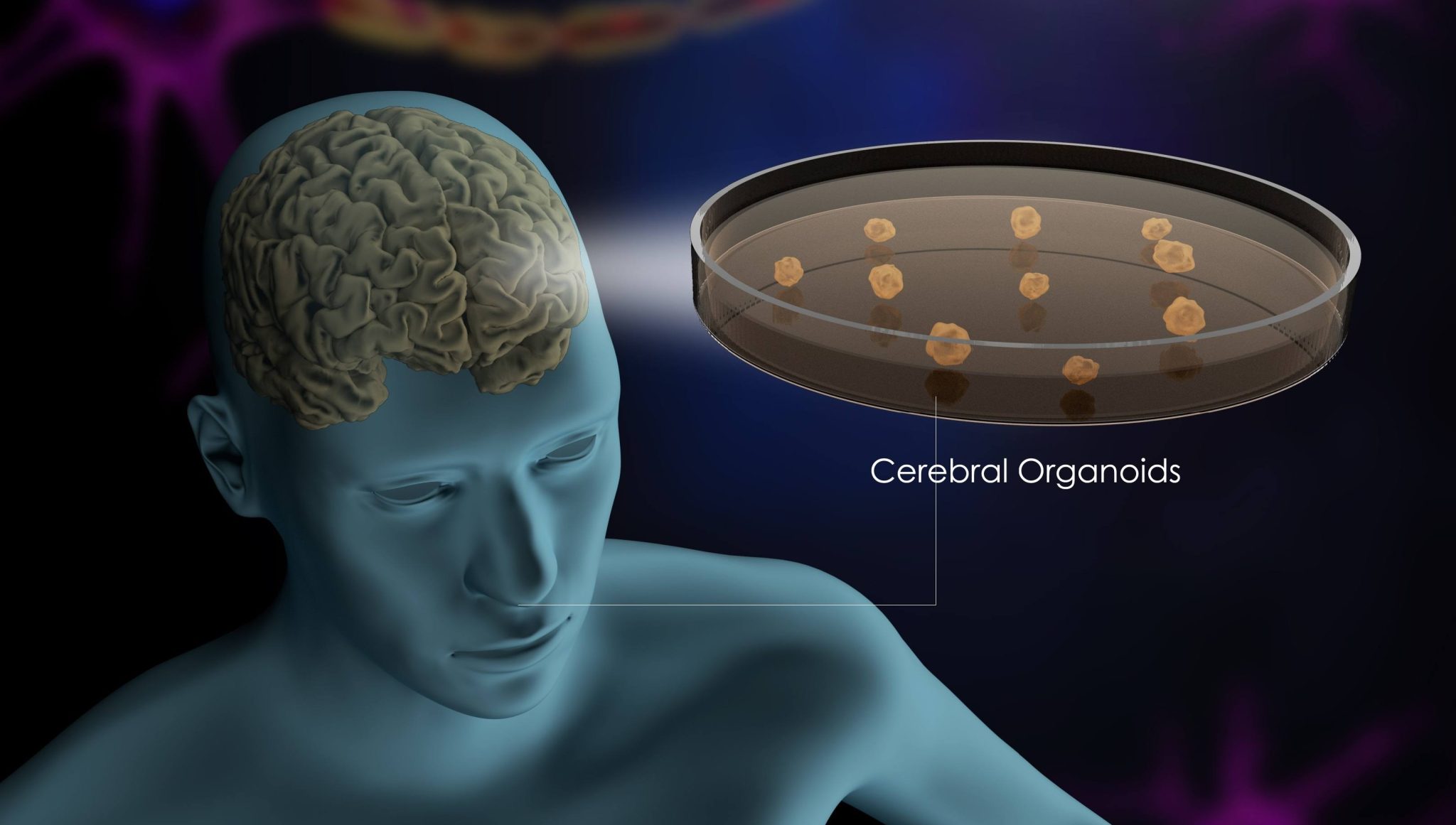 Mayo Clinic 'mini-brain' study reveals possible key link to autism ...