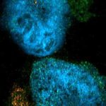 Identifying new potential in cancer-killing T cells - Mayo Clinic News ...