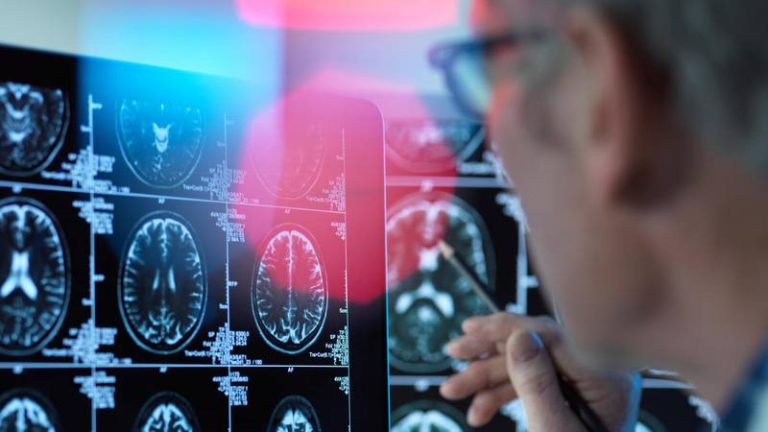 8 innovations in neuroscience and brain research at Mayo Clinic - Mayo ...