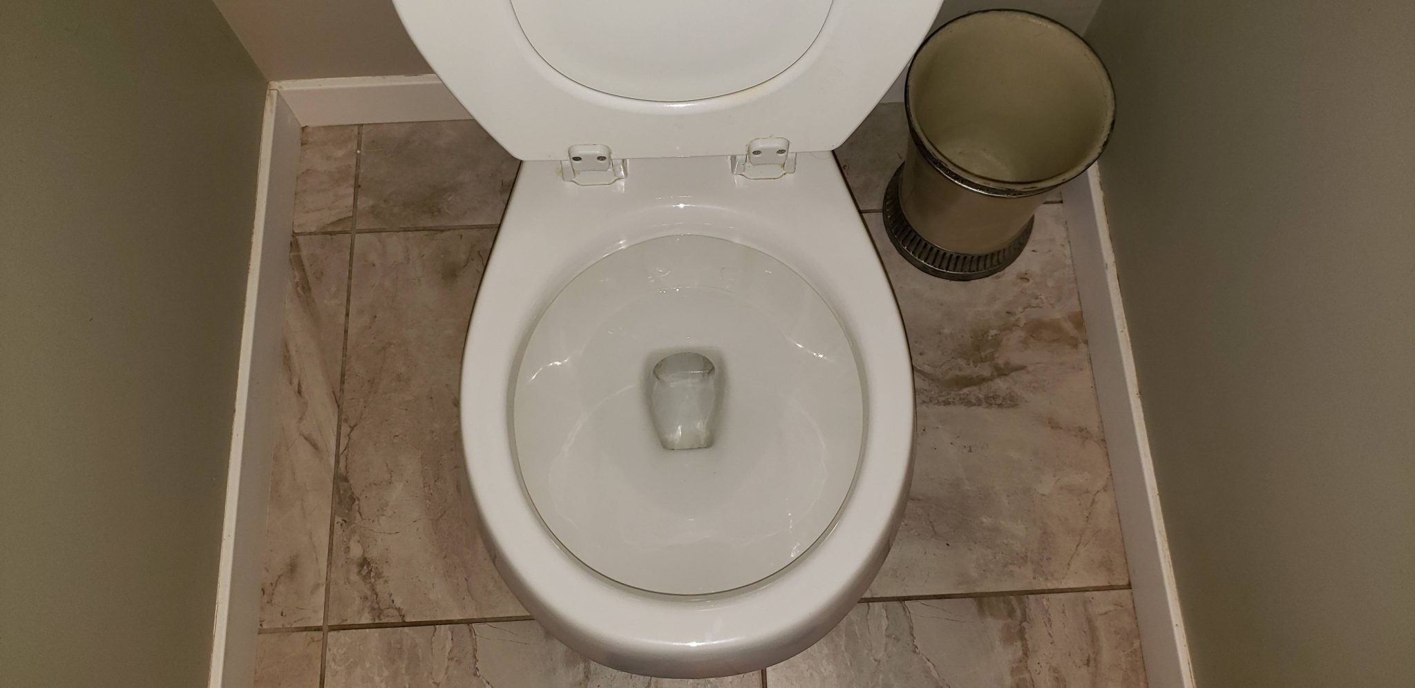 The rainbow of urine colors: What's typical, what's not - Mayo Clinic ...