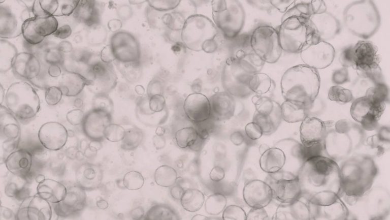 Growing mini-organs to find new treatments for complex disease - Mayo ...