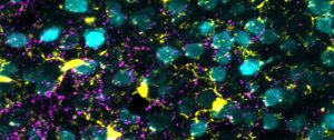 Dancing cells show how the brain awakens from anesthesia - Mayo Clinic ...