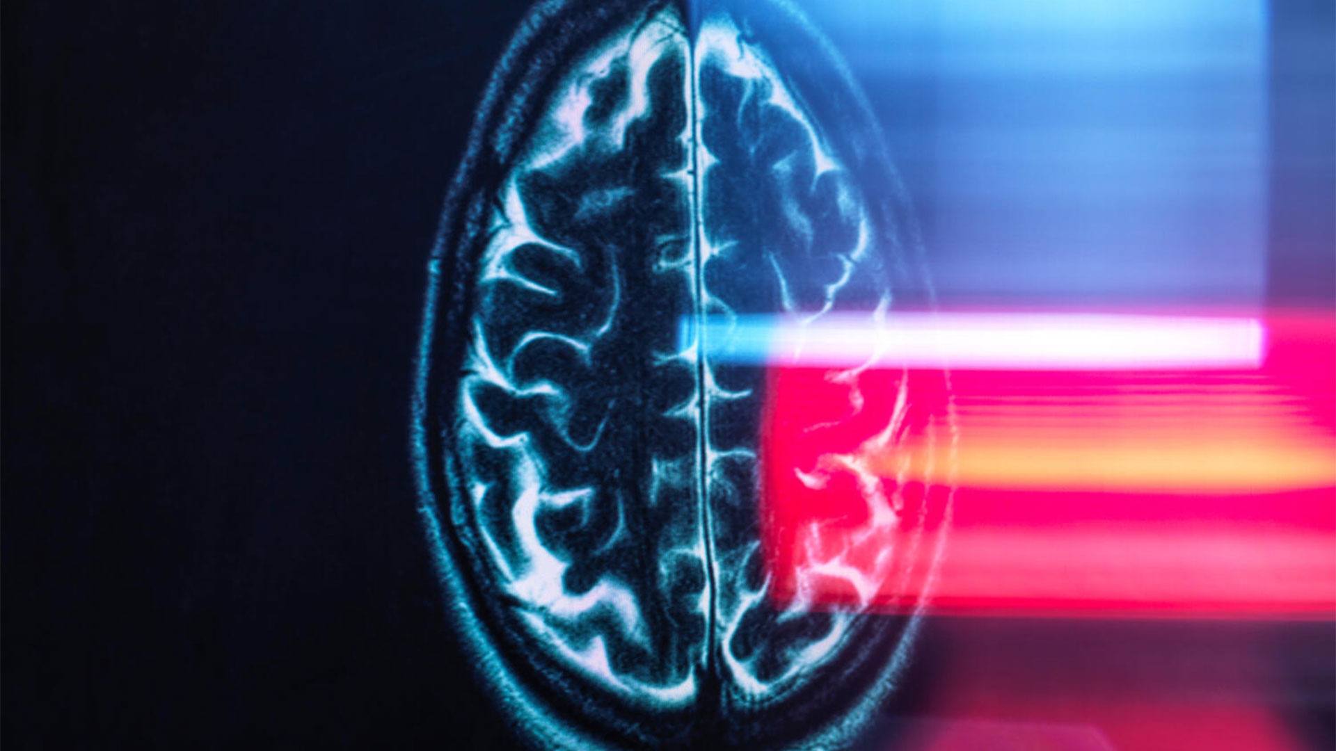 8 innovations in neuroscience and brain research at Mayo Clinic - Mayo ...