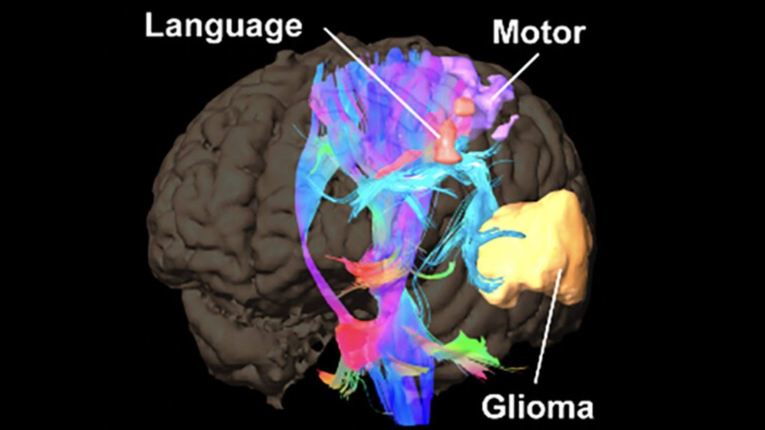 8 innovations in neuroscience and brain research at Mayo Clinic - Mayo ...