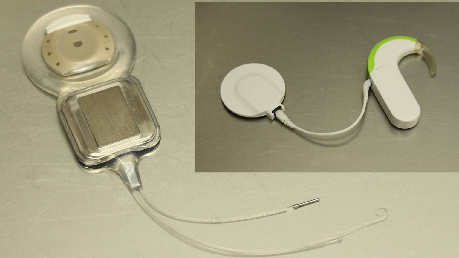 Can cochlear implants slow dementia in older adults? - Mayo Clinic News Network