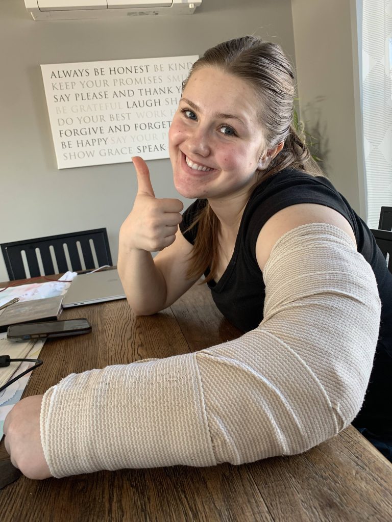 New elbow surgery technique developed at Mayo Clinic helps wrestler get ...