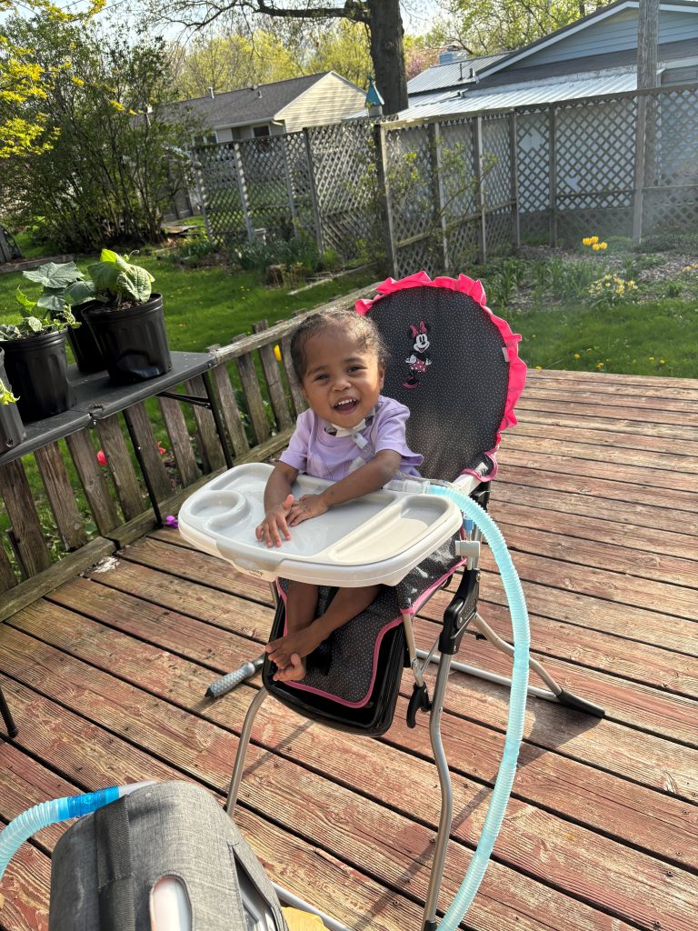 Baby Makrii breathes easier after innovative airway surgery at Mayo ...