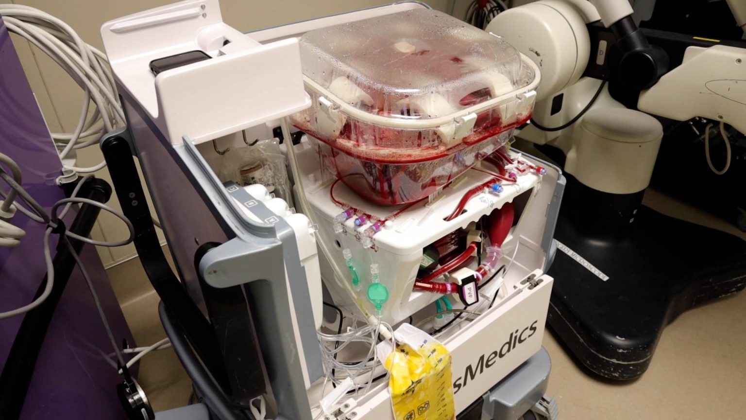 (VIDEO) Harnessing the power of innovation and a patient's will to ...