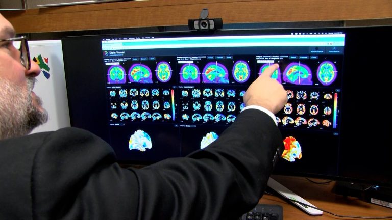 Mayo Clinic Neurology AI Program tests platform to detect brain ...