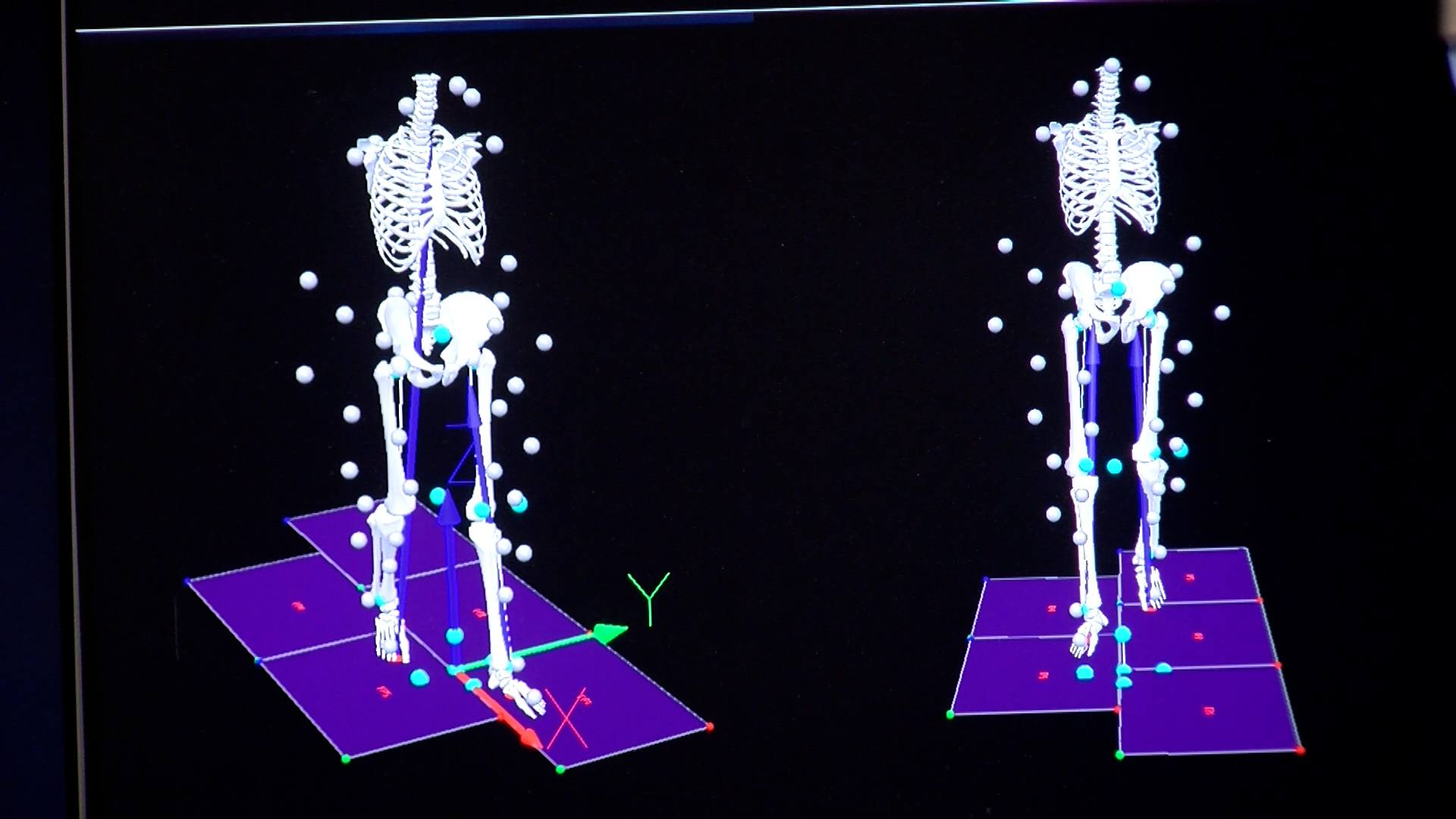 (VIDEO) Multiple sclerosis fuels artist's work - Mayo Clinic News Network