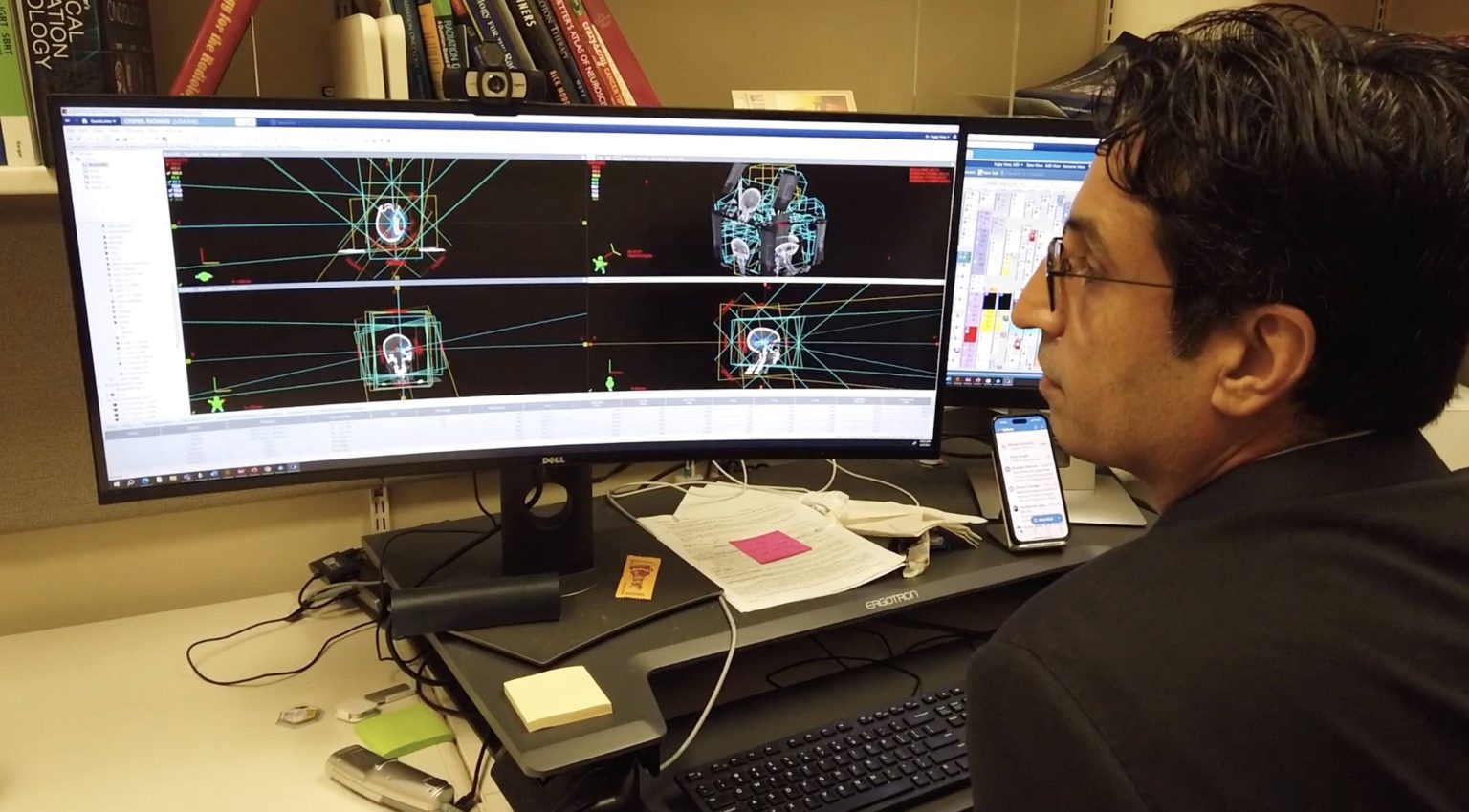 (VIDEO) Breakthrough in the fight against glioblastoma - Mayo Clinic ...