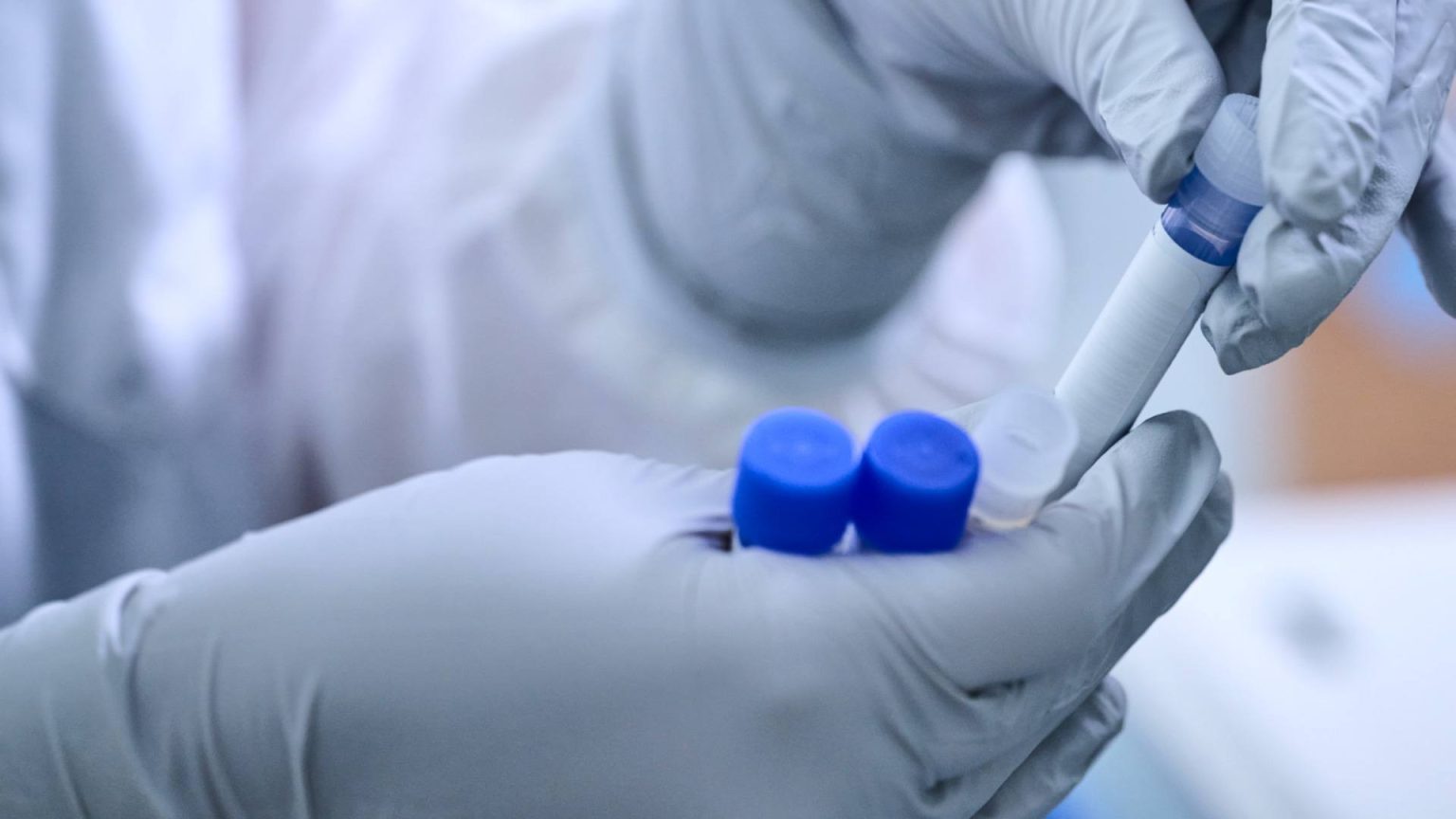 Mayo Clinic Laboratories and Amprion announce collaboration to advance ...