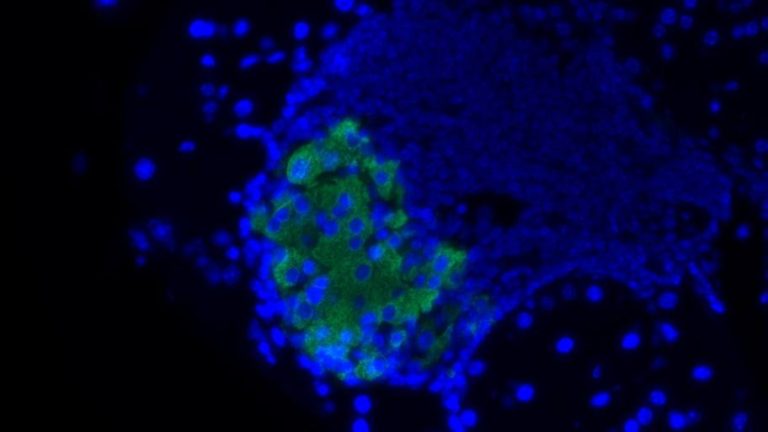 Mayo Clinic researchers find 'sugar coating' cells can protect those ...